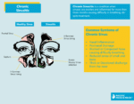 Chronic Sinusitis - Pacific Head & Neck