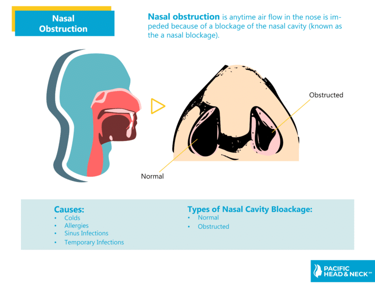 Nasal Obstruction - Pacific Eye & Ear Specialists