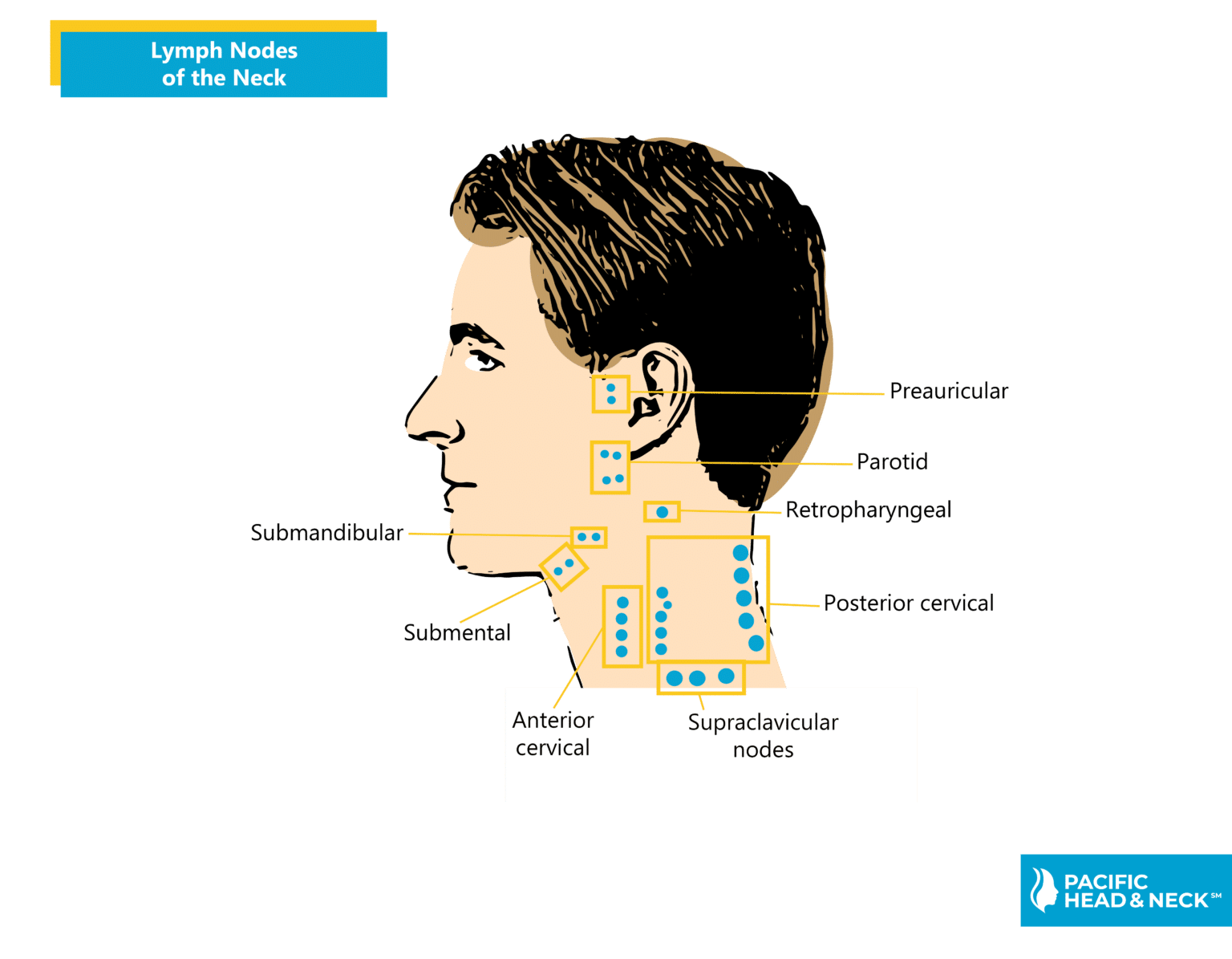 Neck Dissection - Pacific Head & Neck