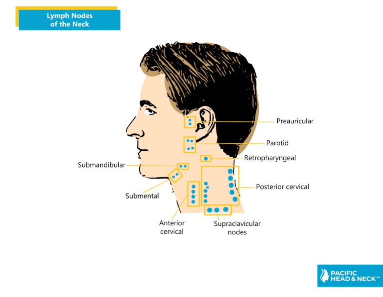 Neck Dissection Pacific Head And Neck