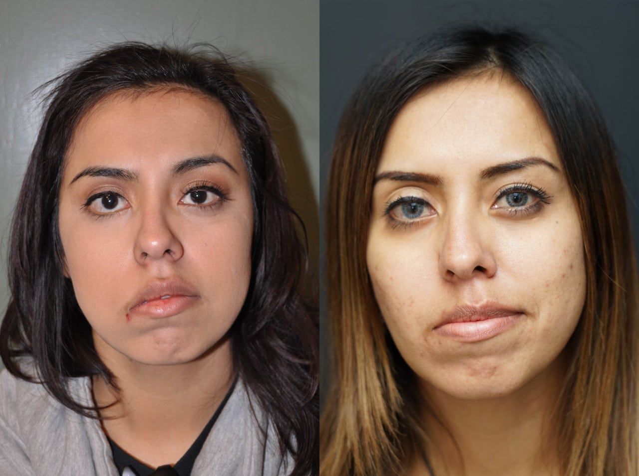 Case Presentation - Facial Paralysis - Pacific Head and Neck